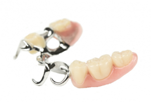 Cast Partial Dentures - Dental Laboratory for Case Partial Dentures