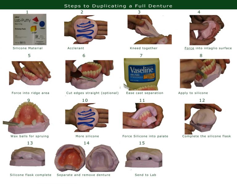how-to-duplicate-a-full-denture-arklign