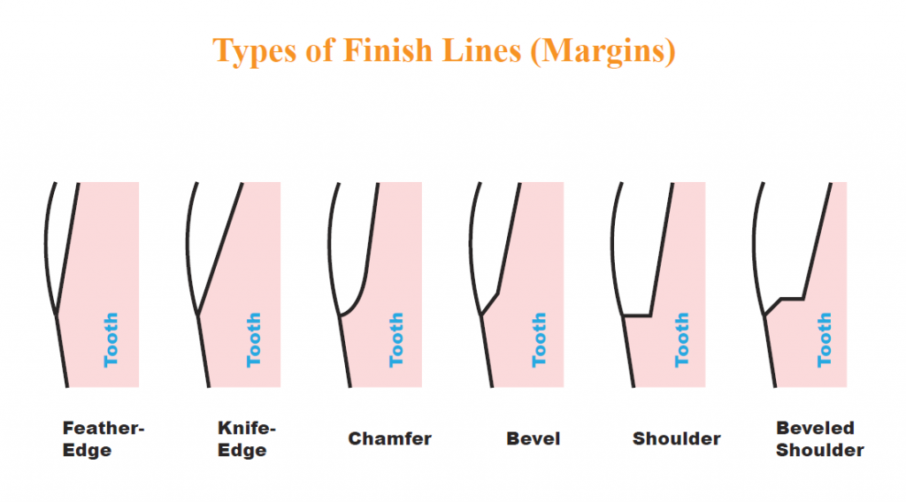 What Are The Types Of Finish Lines margins Arklign
